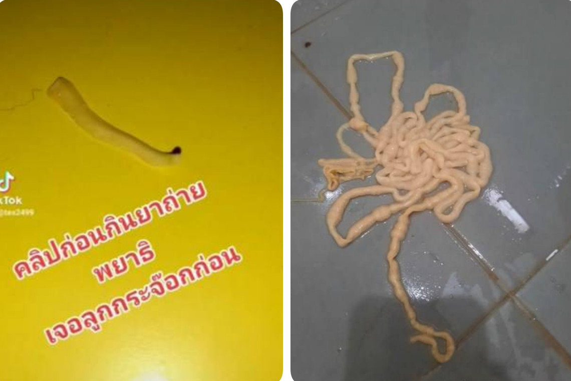 อวสาน ซอยจุ๊ หนุ่มรีวิวเตือนภัยชอบกินดิบ ชีวิตเสี่ยงตายกินยาถ่าย เจอสิ่งมีชีวิตยาวกว่า 2 เมตร ...